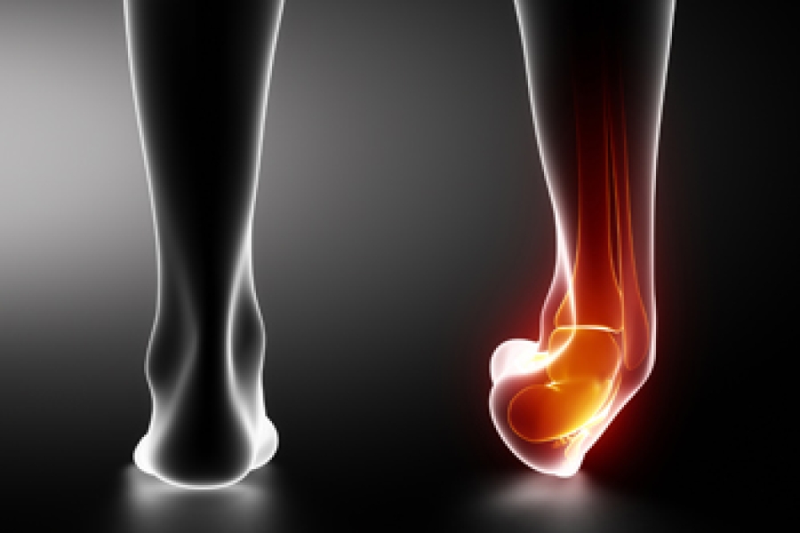 Types and Causes of Ankle Dislocations